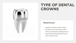 Understanding Different Type of Dental Crowns.pptx