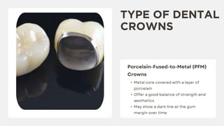 Understanding Different Type of Dental Crowns.pptx