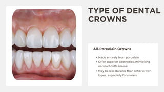 Understanding Different Type of Dental Crowns.pptx