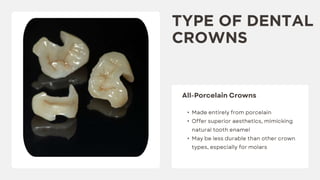 Understanding Different Type of Dental Crowns.pptx