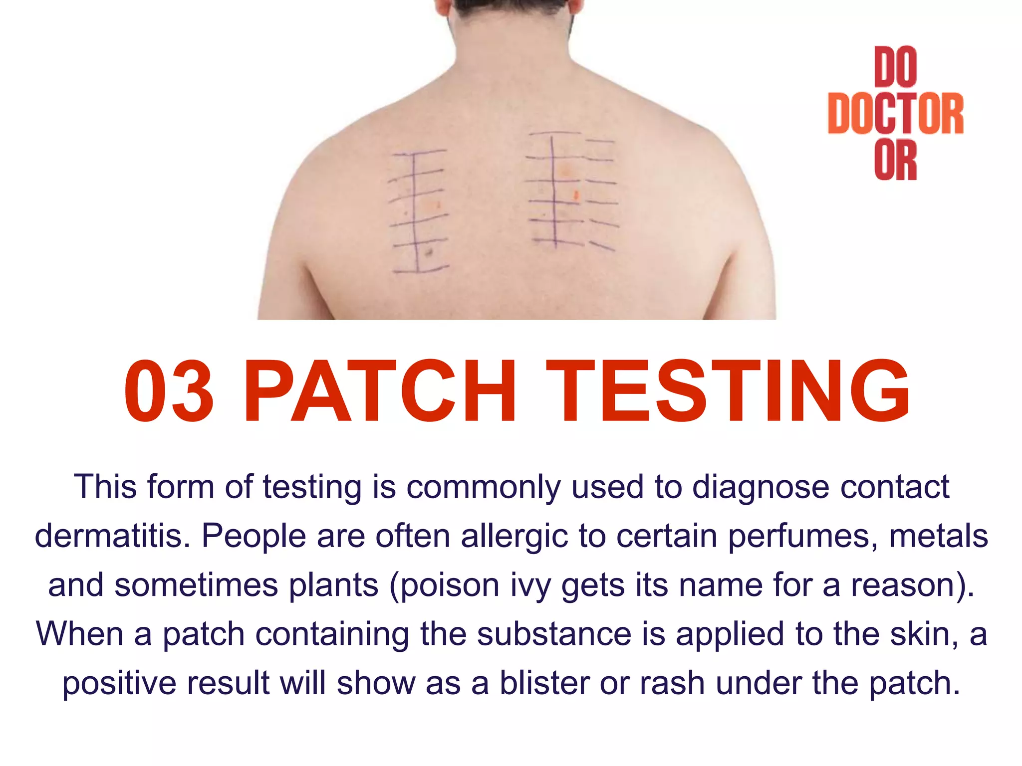 Different Types of Allergy Testing | PPTX