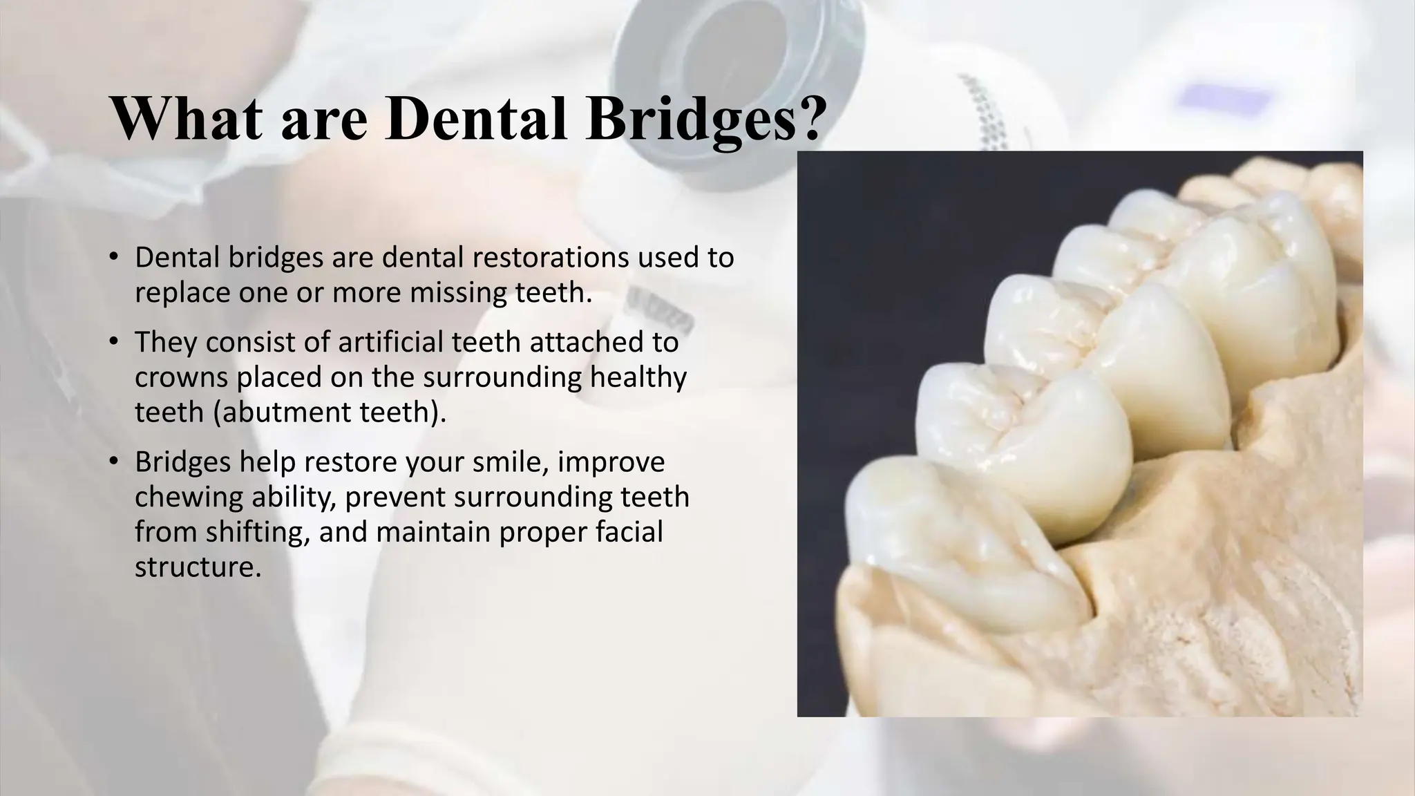 Different Types of Dental bridges - Green Valley Smile Care.pptx