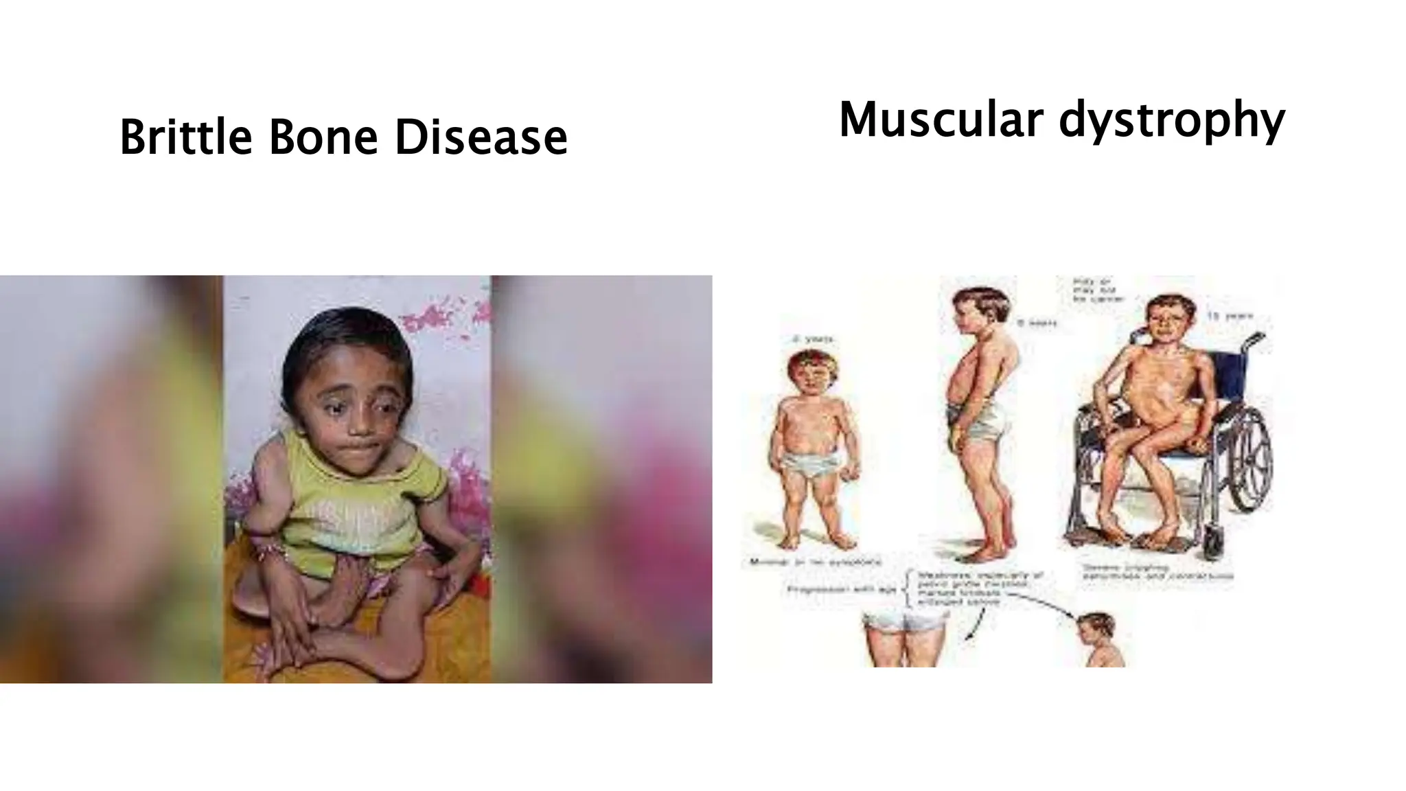 Presentation on Different Types of Disabilities.pptx