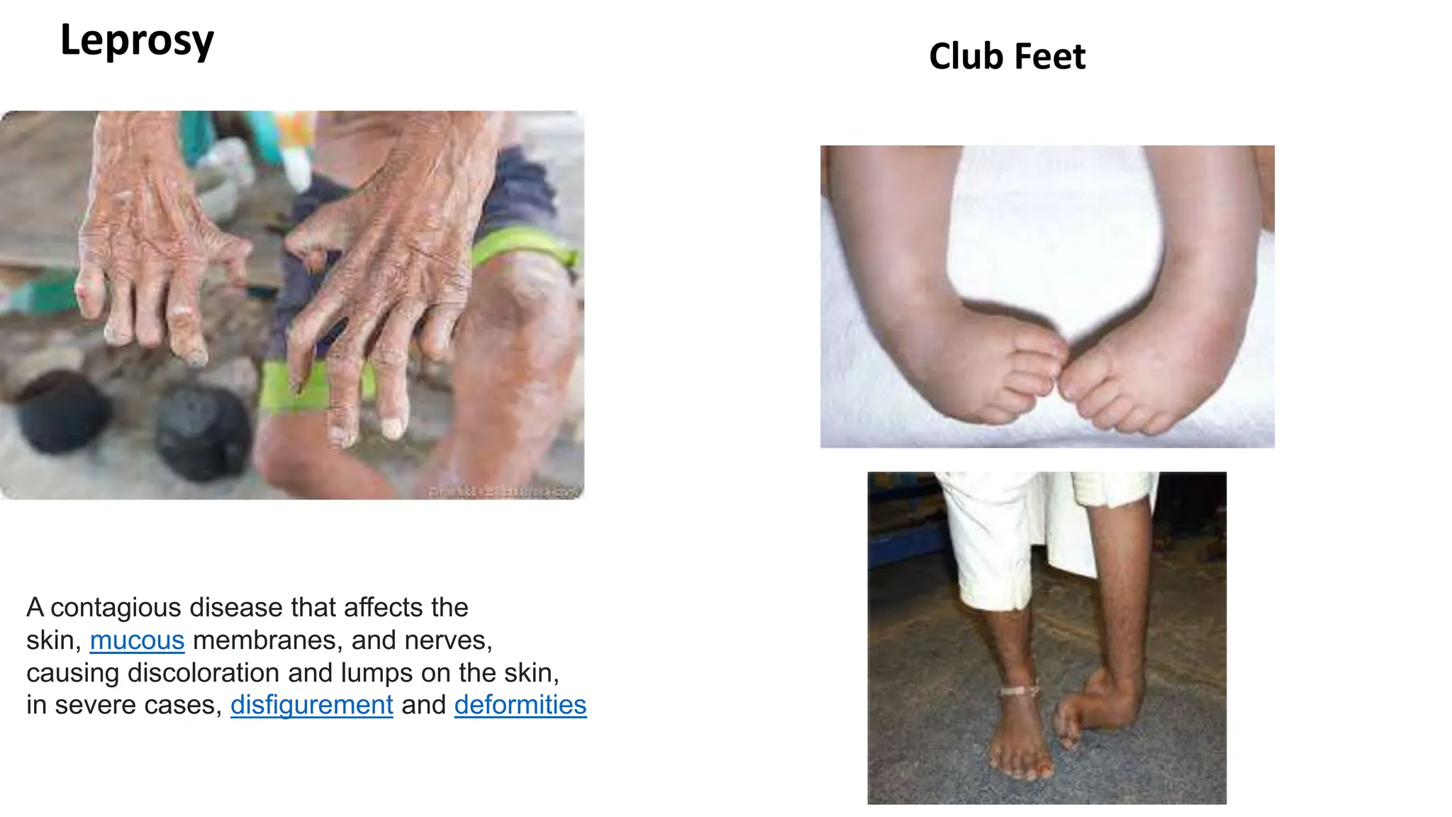 Presentation on Different Types of Disabilities.pptx