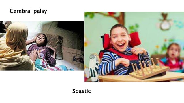 Presentation on Different Types of Disabilities.pptx
