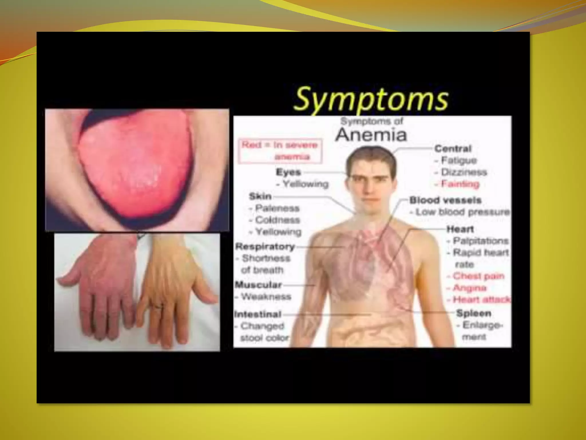Different types of diseases | PPTX