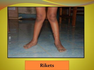 Different types of diseases | PPTX