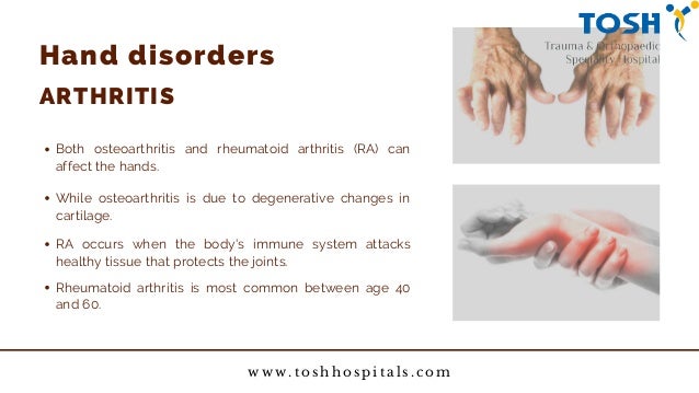 Different types of hand disorders