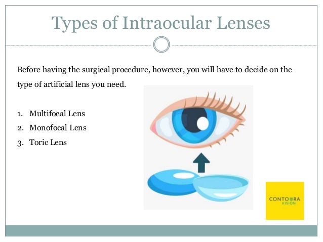 Different Types of Intraocular Lenses in Cataract Surgery.pptx