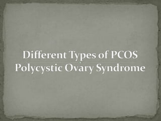 Types of PCOS | PPTX