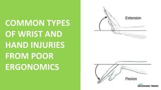 Different types of Wrist Movements Explained | PPTX