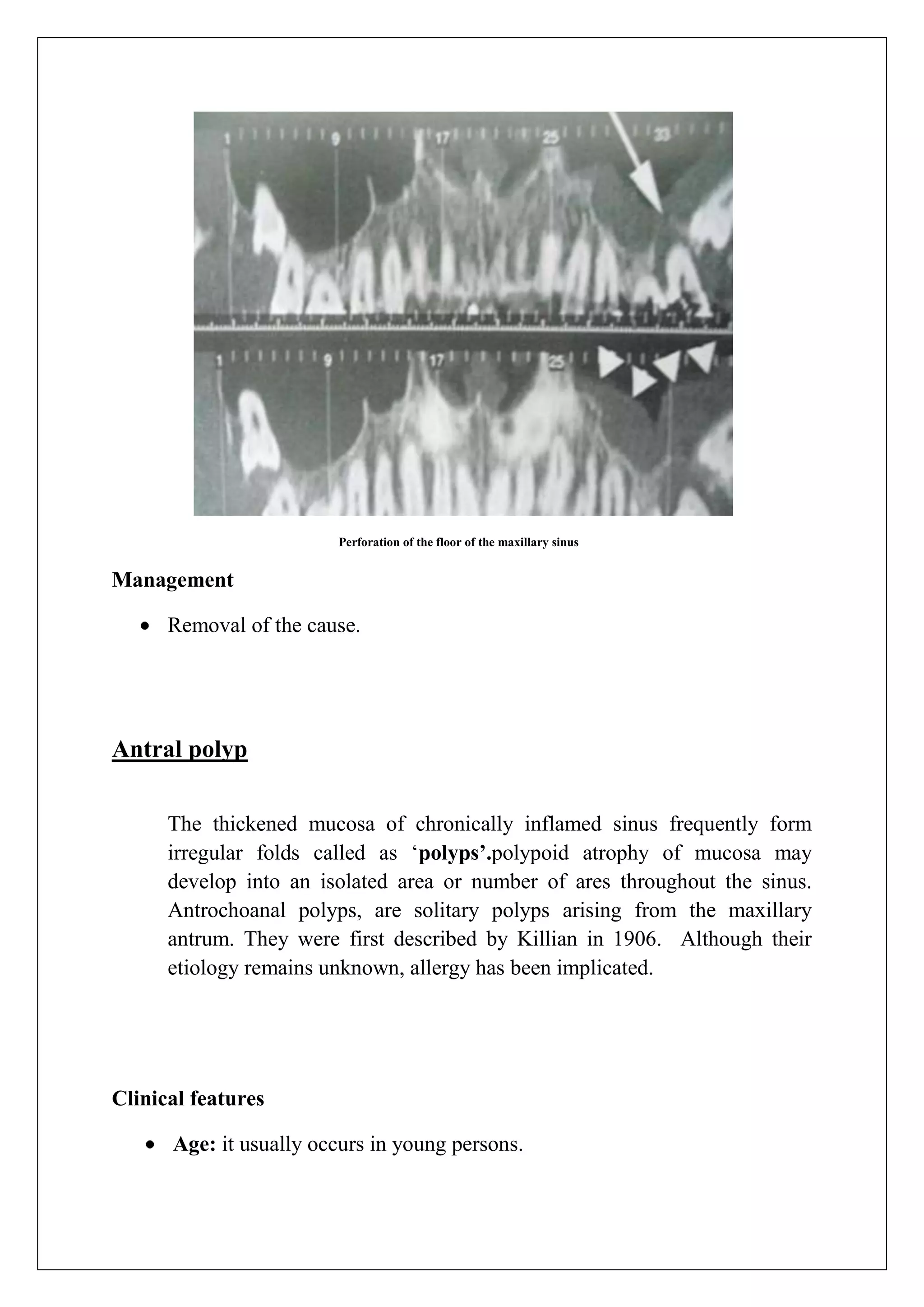 Differiential diagnosis of maxillary sinus pathology | DOCX