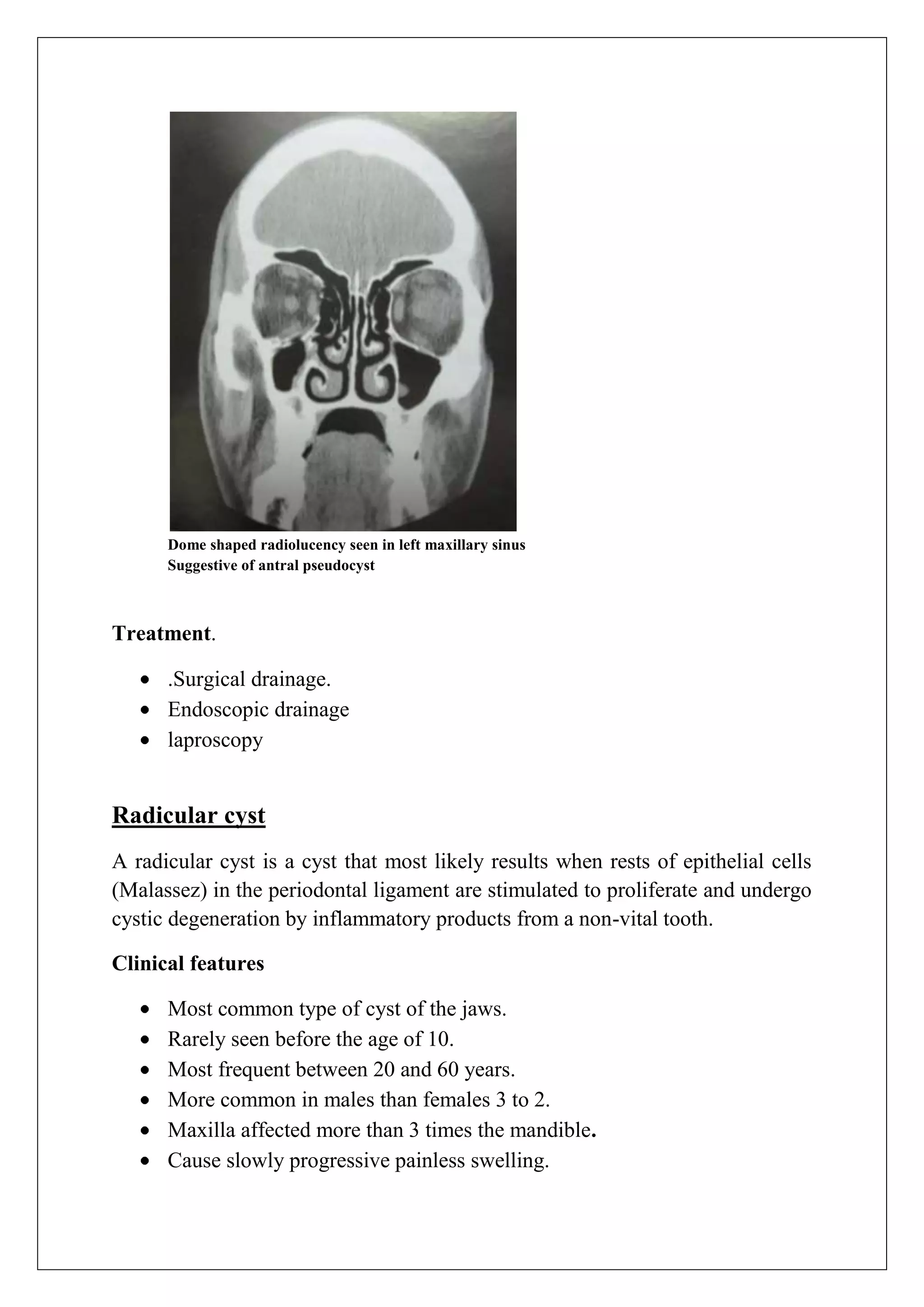 Differiential diagnosis of maxillary sinus pathology | DOCX