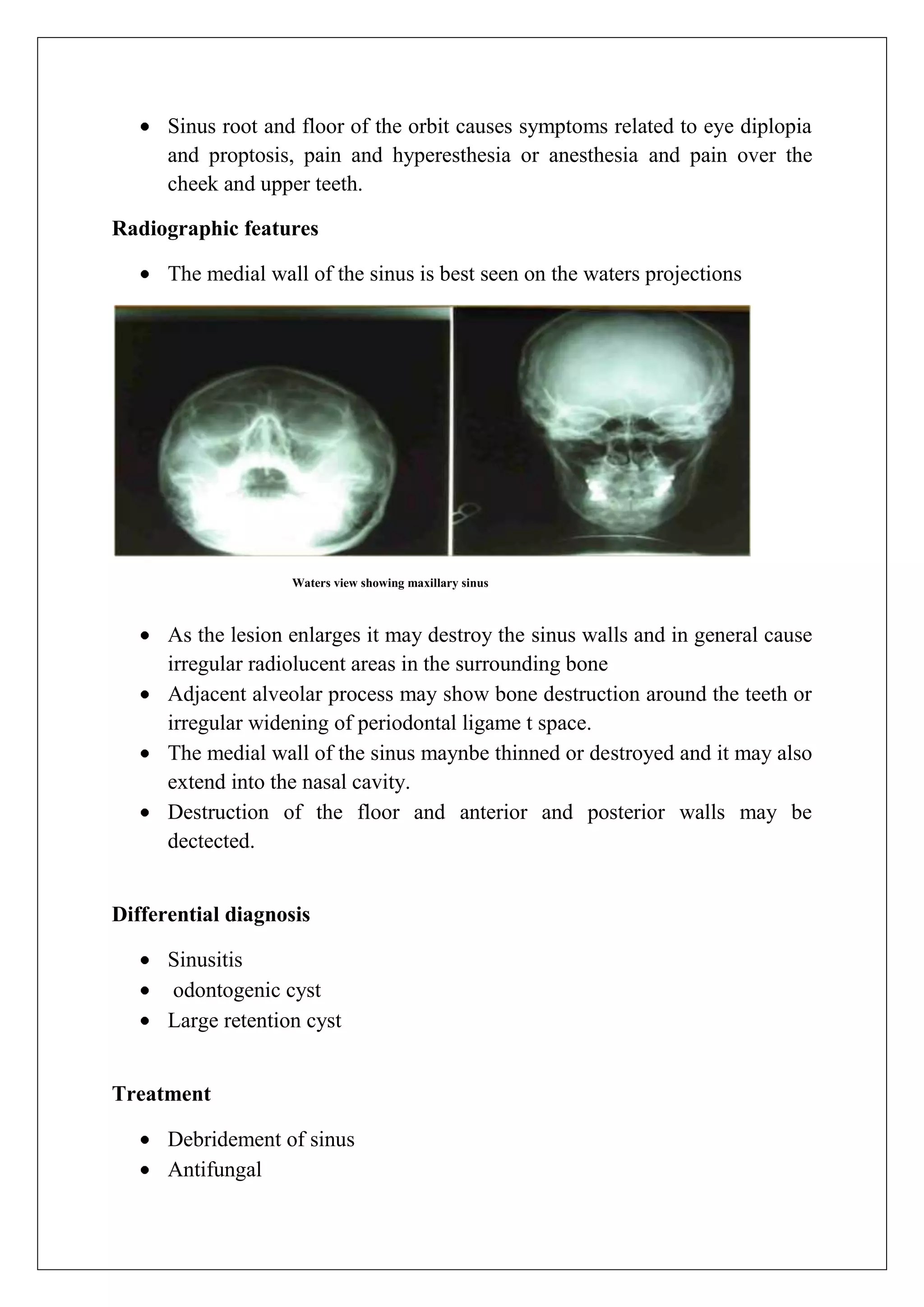 Differiential diagnosis of maxillary sinus pathology | DOCX
