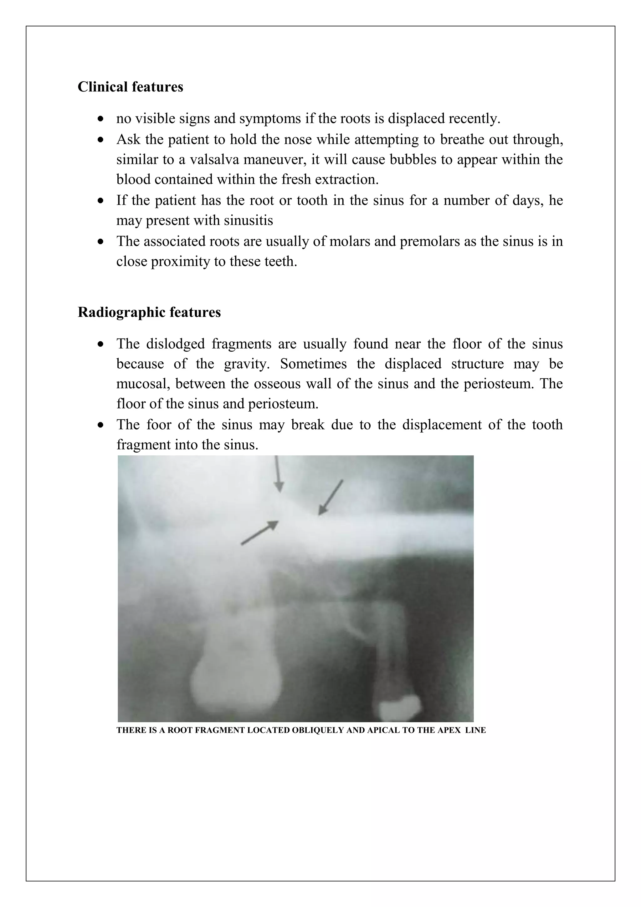 Differiential diagnosis of maxillary sinus pathology | DOCX