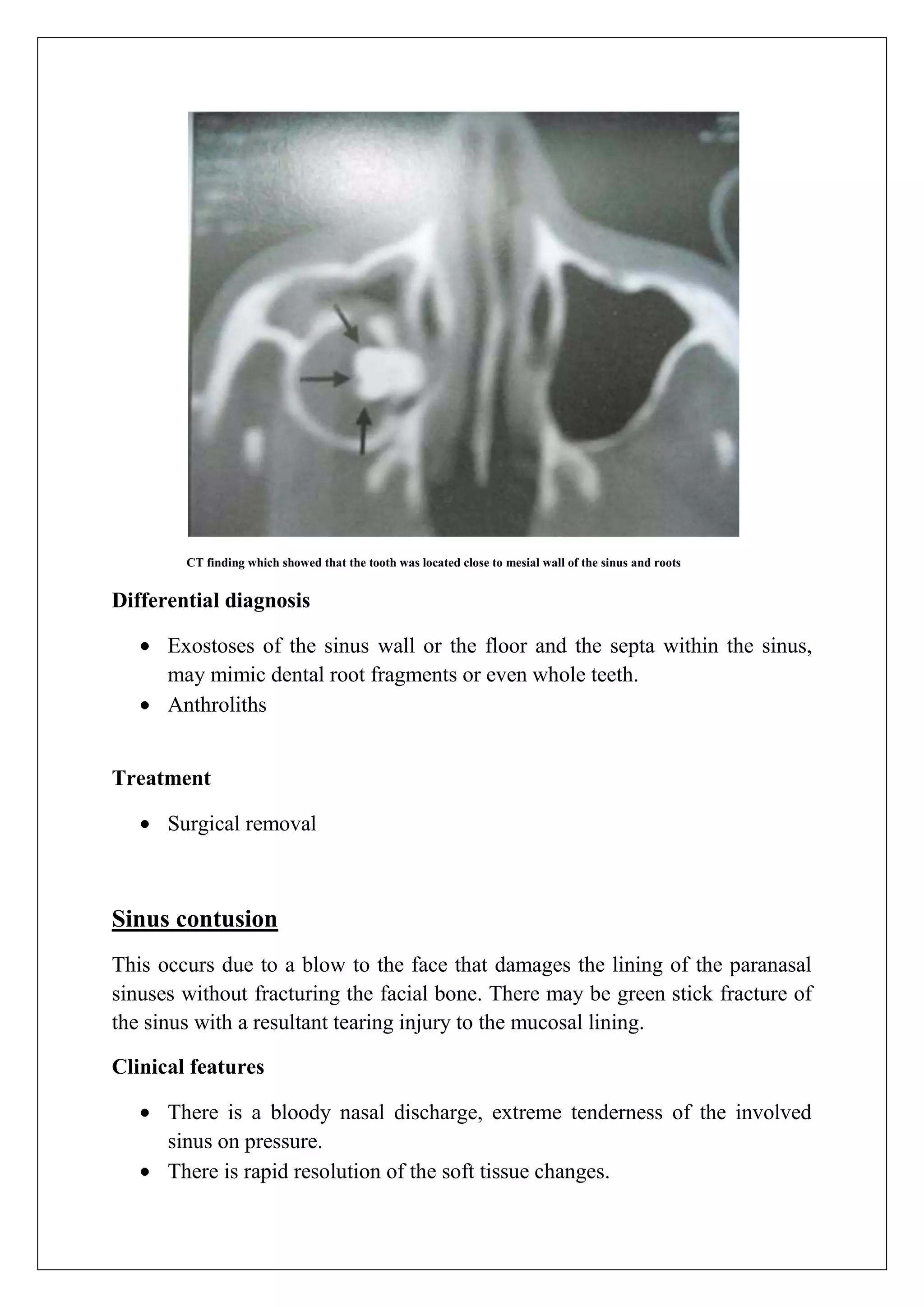 Differiential diagnosis of maxillary sinus pathology | DOCX