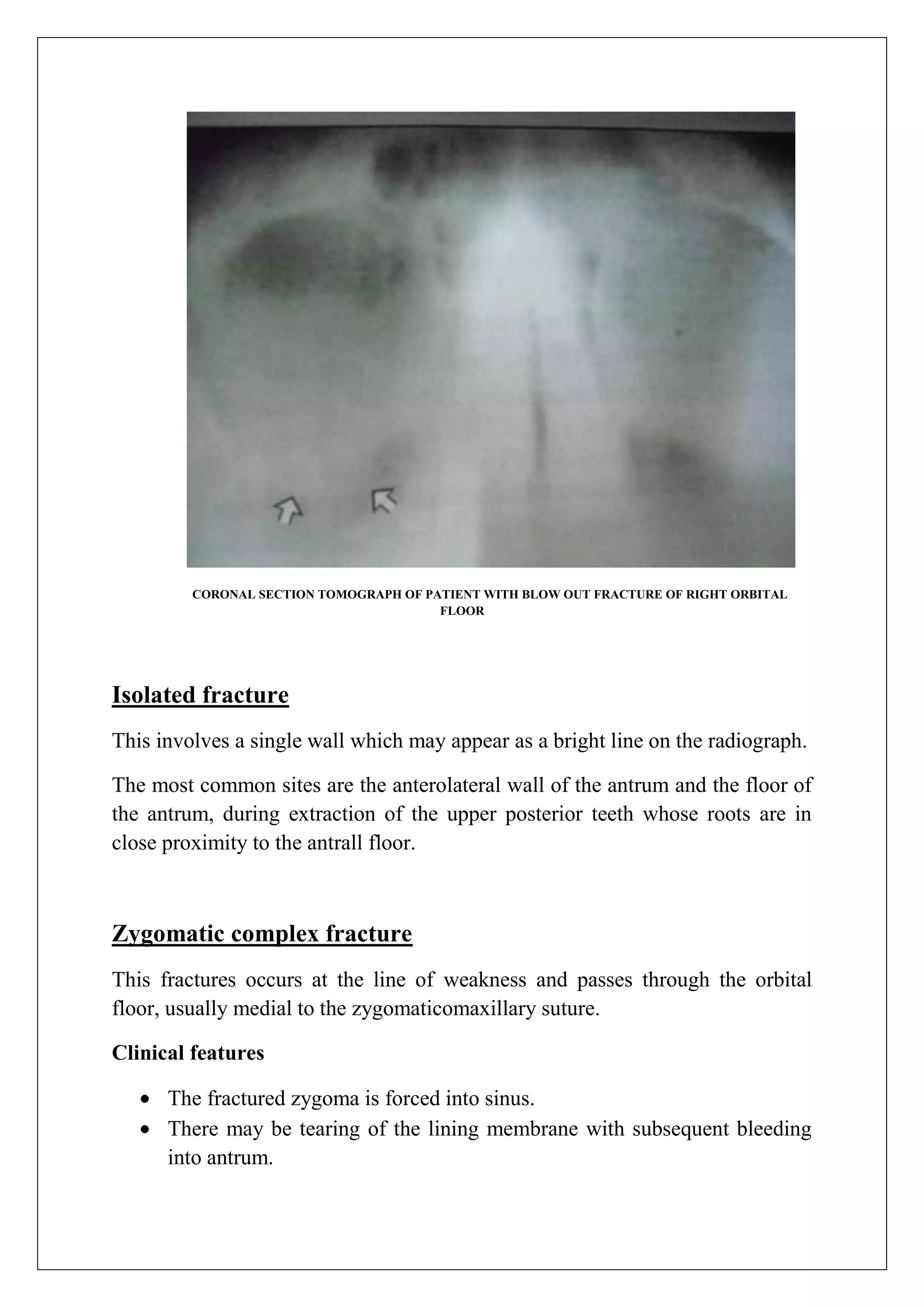 Differiential diagnosis of maxillary sinus pathology | DOCX