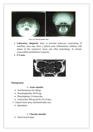 Differiential diagnosis of maxillary sinus pathology | DOCX