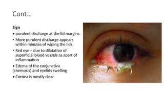 DIFFERNTIAL DIAGNOSIS OF RED EYE-1.pptxbnsnsn | PPTX
