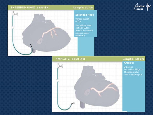 Difficult Coronary Sinus Lead Implantation | PPT
