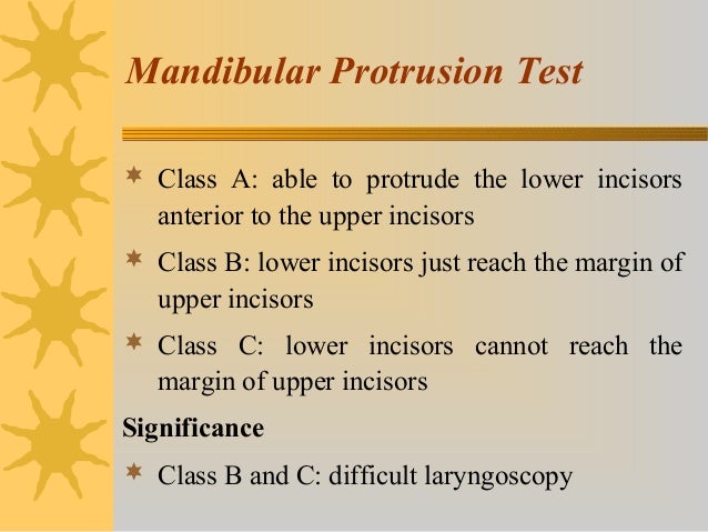 Difficult airway-assessment | PPT