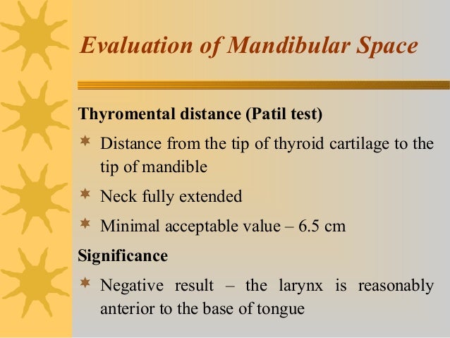 Difficult airway-assessment | PPT