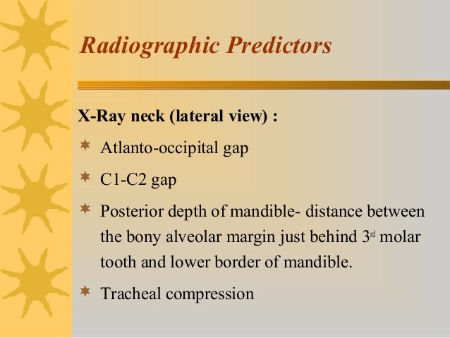 Difficult airway-assessment | PPT