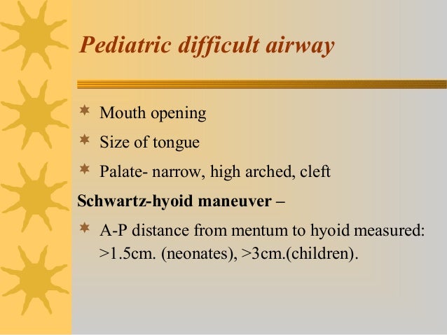 Difficult airway-assessment | PPT