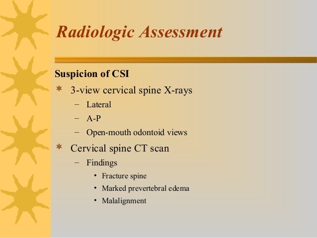Difficult airway-assessment | PPT