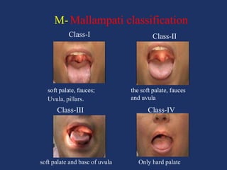 Difficult Airway Management | Jindal Chest Clinic | PPT