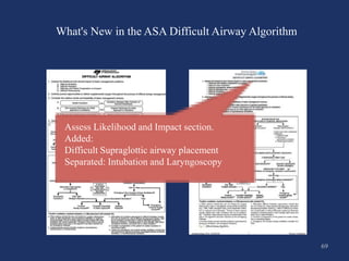 Difficult Airway Management | Jindal Chest Clinic | PPT