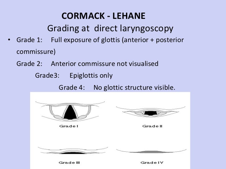 Difficult airway