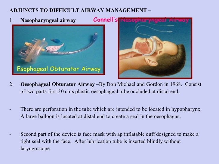 Difficult airway