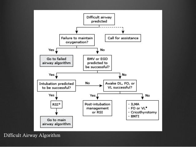 Difficult airway management