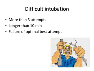 Difficult airway. | PPT