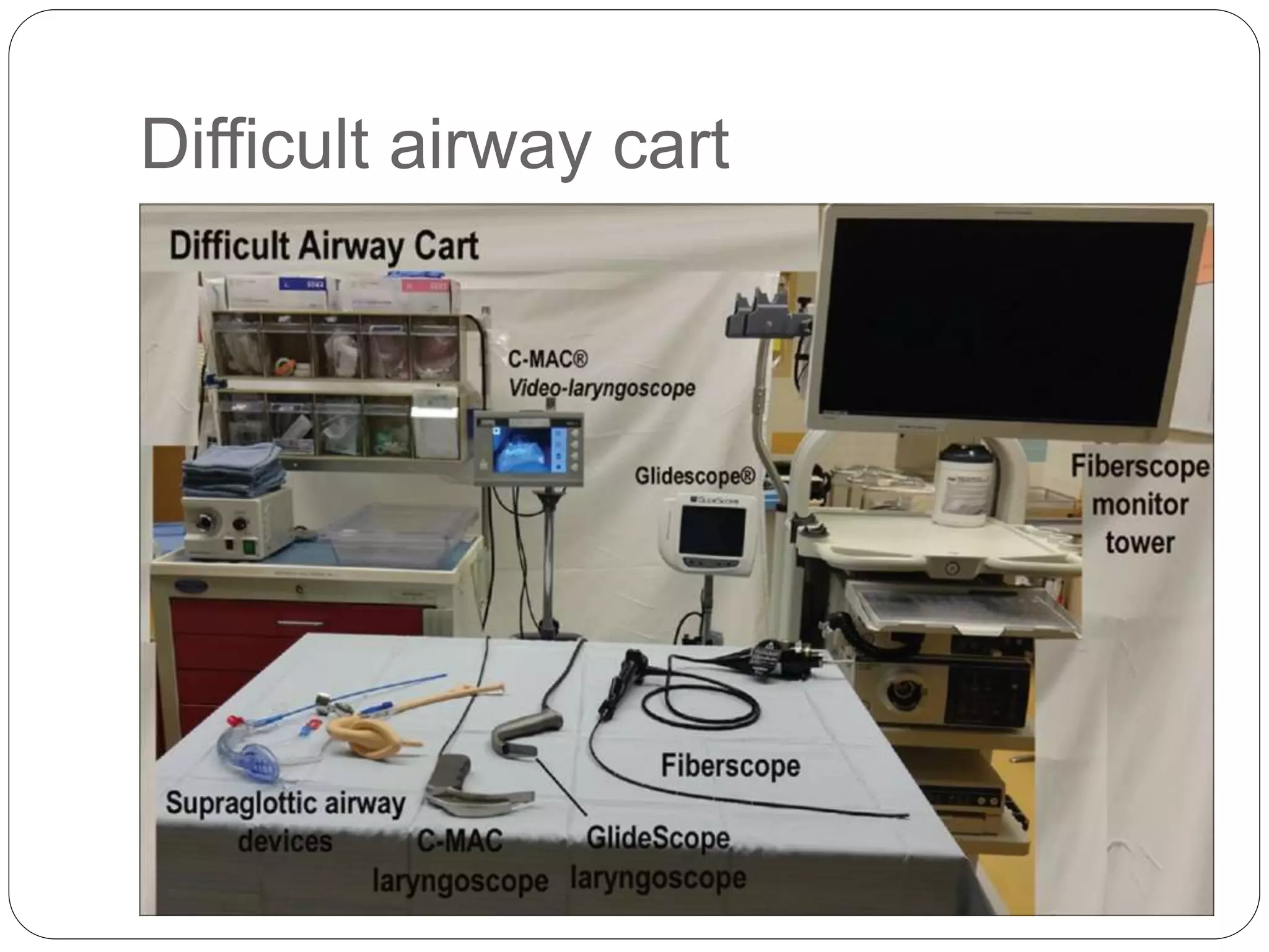 Difficult airway | PPTX