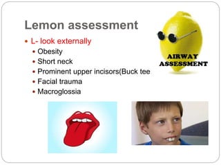 Difficult airway | PPTX