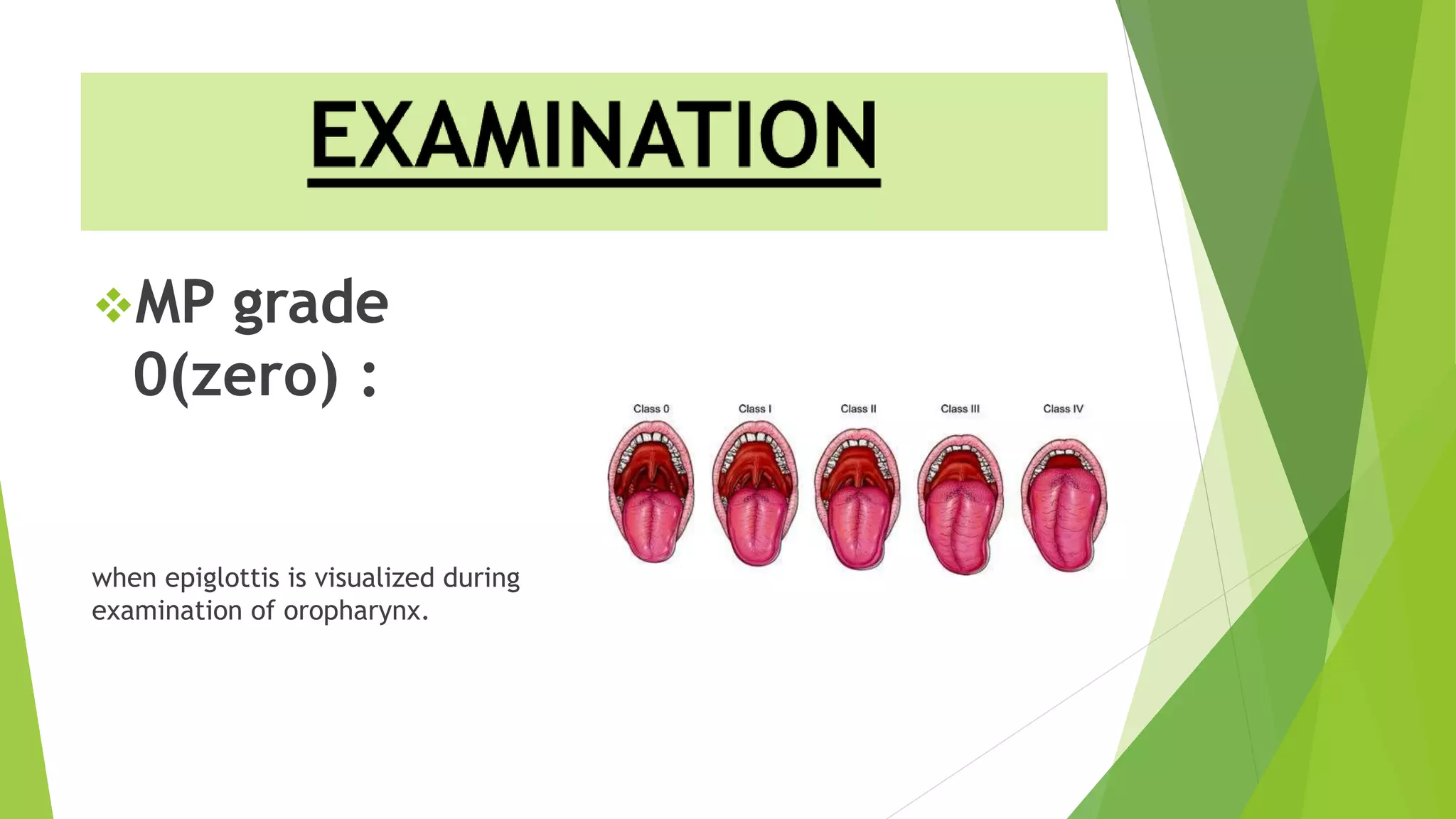 Difficult airway | PPTX