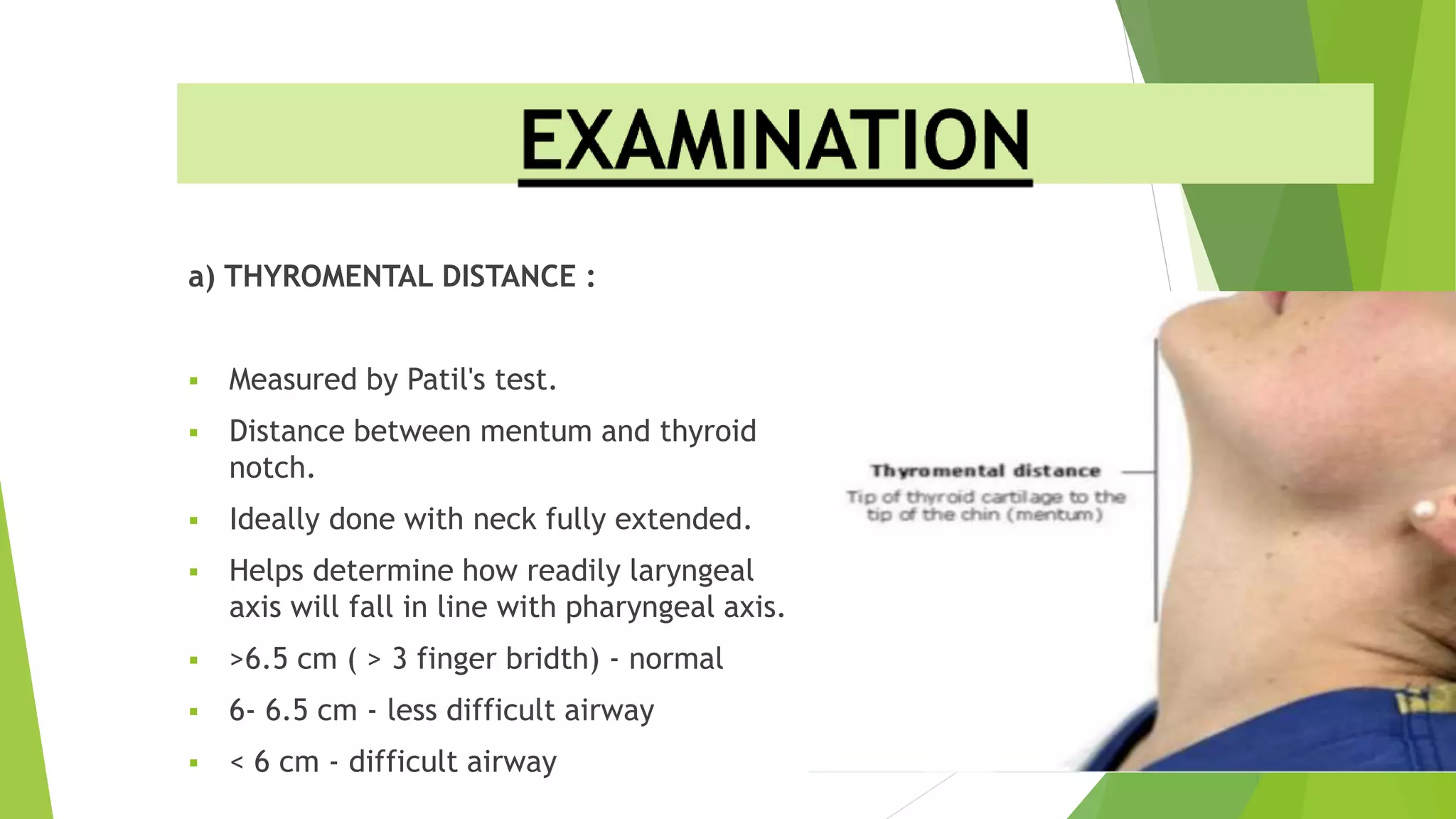 Difficult airway | PPTX