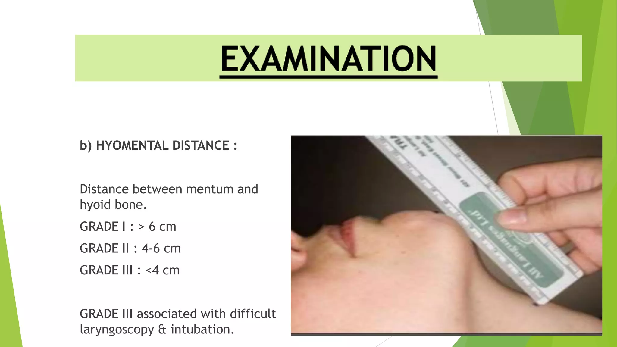 Difficult airway | PPTX