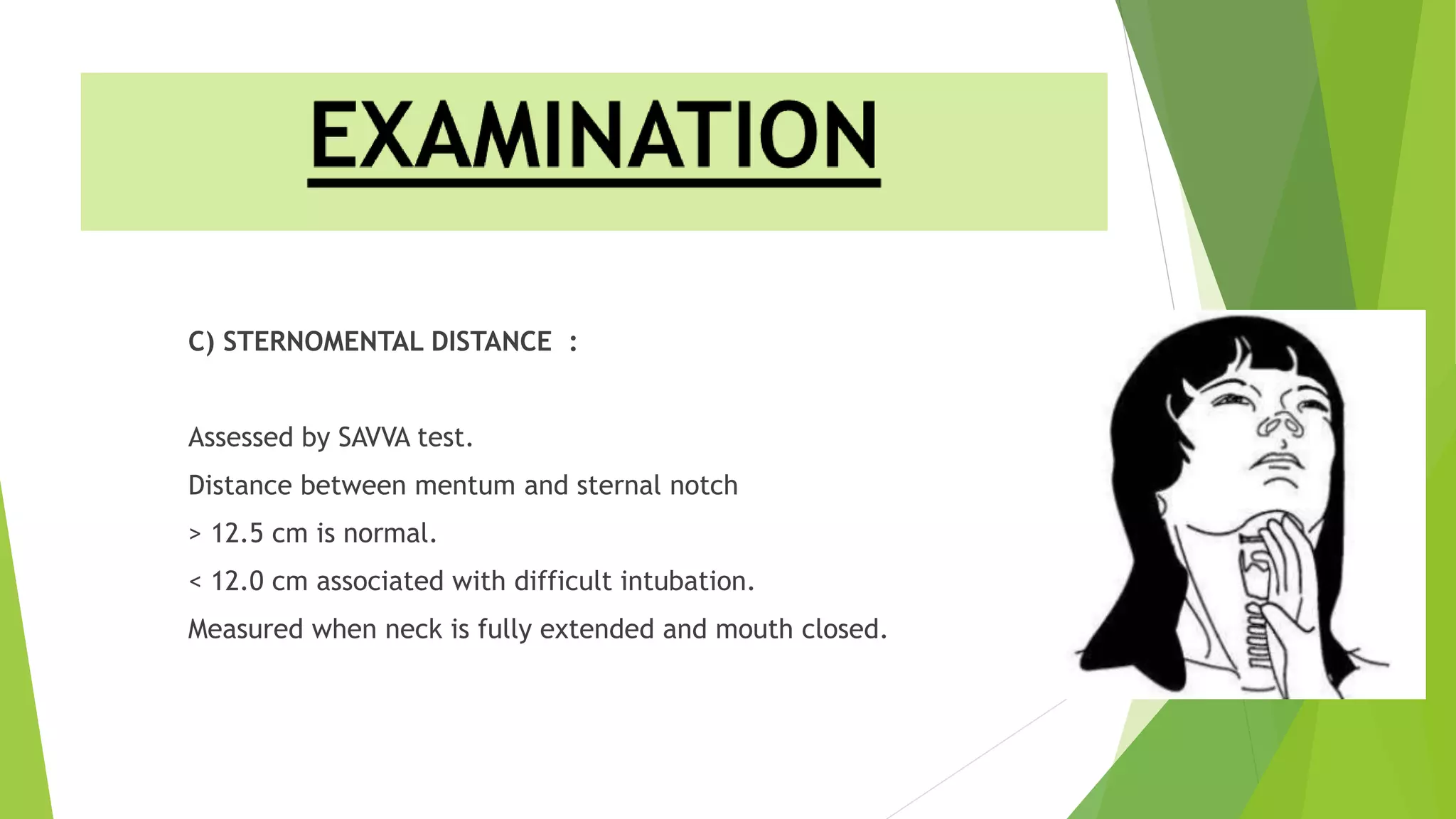 Difficult airway | PPTX
