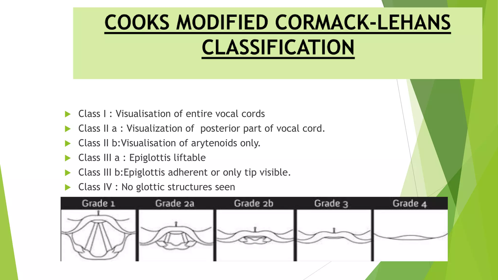 Difficult airway | PPTX