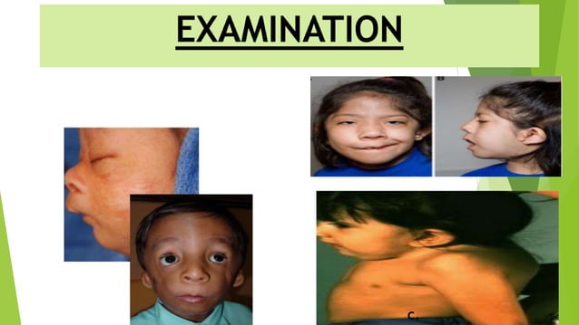Difficult airway | PPTX