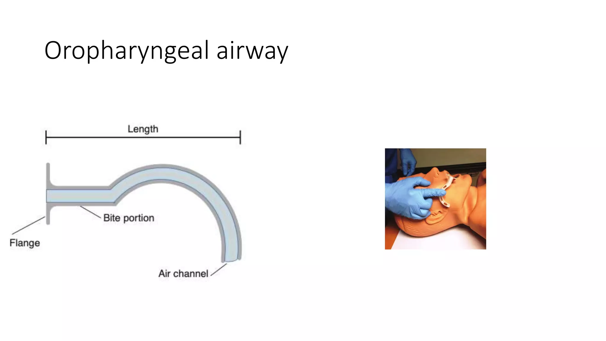 Difficult Airway.pptx