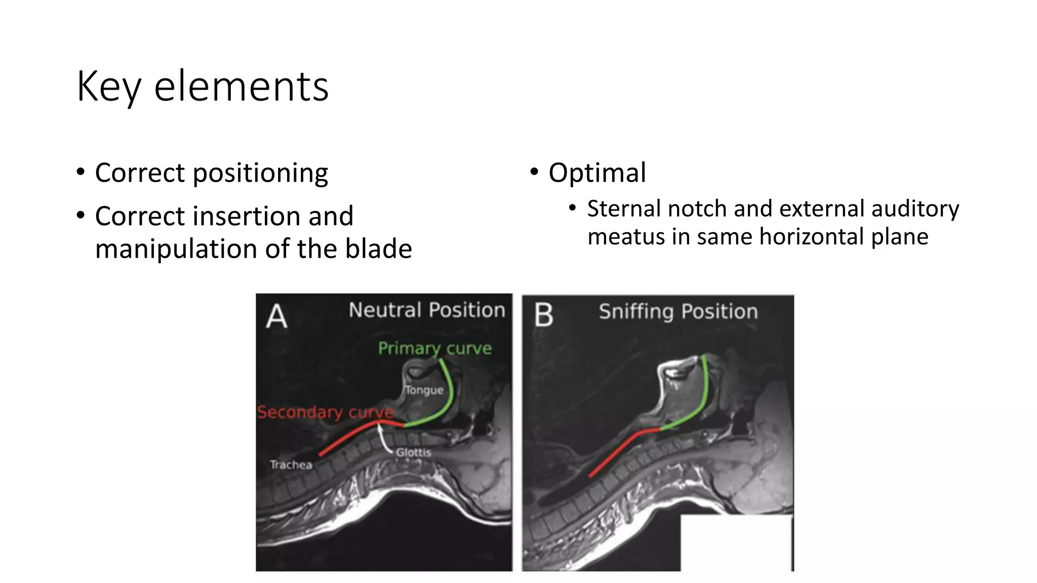 Difficult Airway.pptx