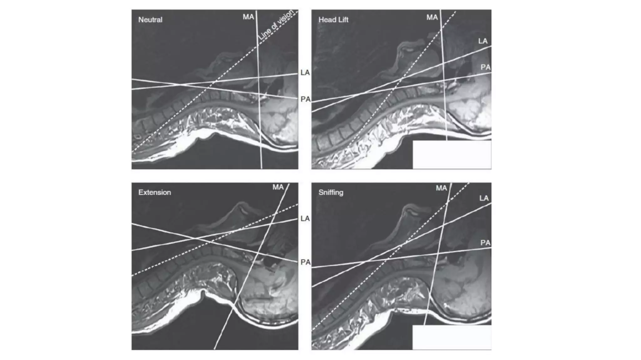 Difficult Airway.pptx