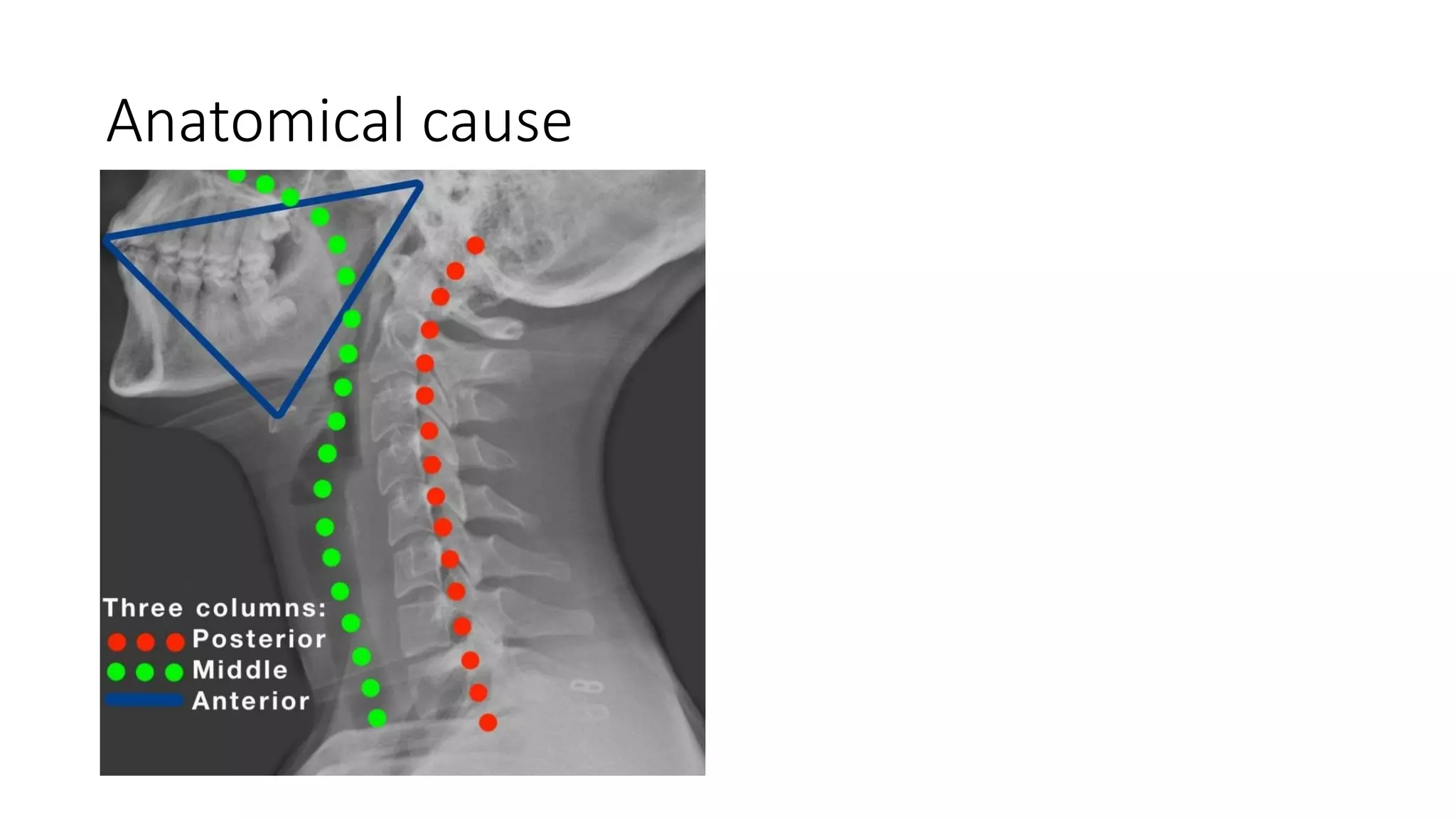 Difficult Airway.pptx