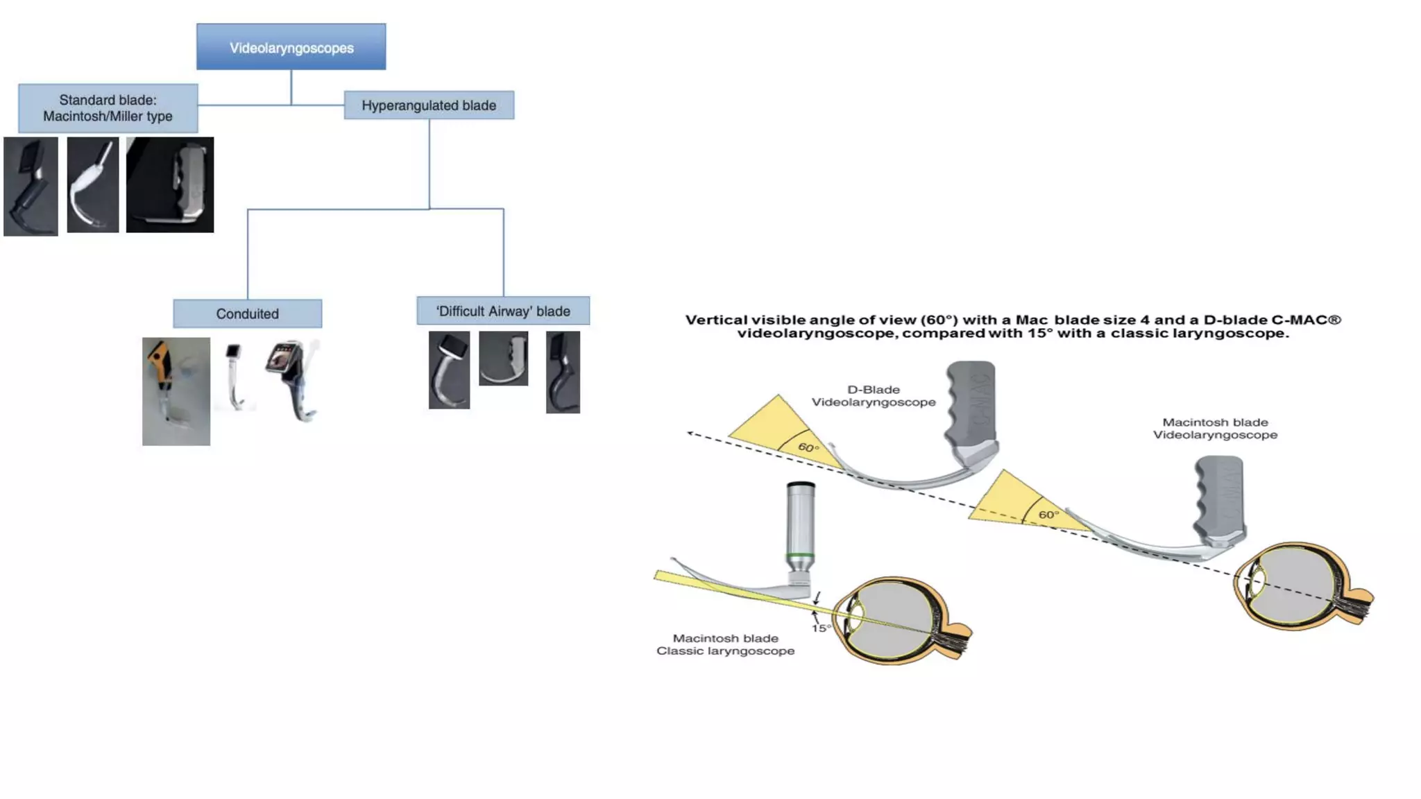 Difficult Airway.pptx