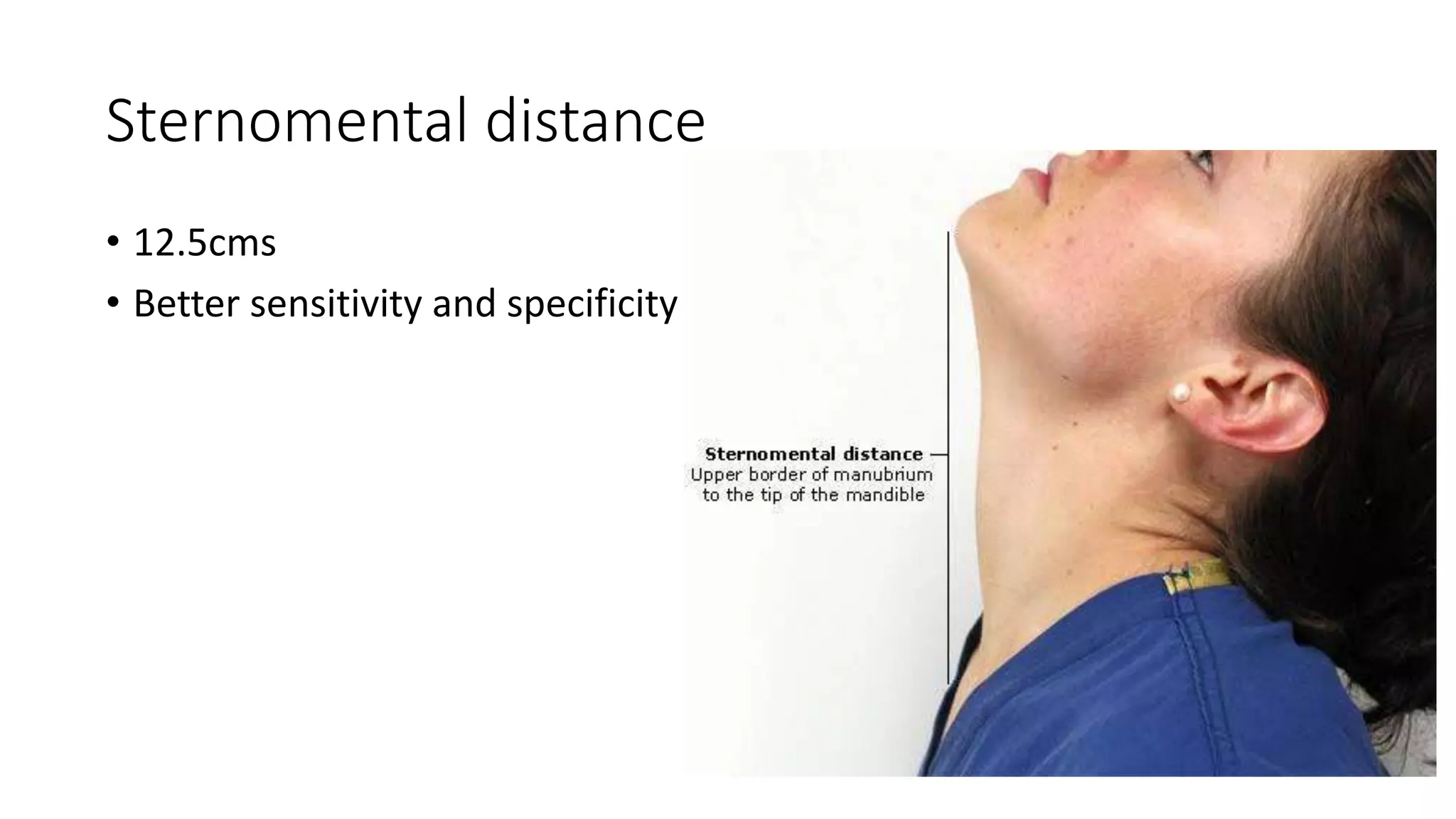 Difficult Airway.pptx