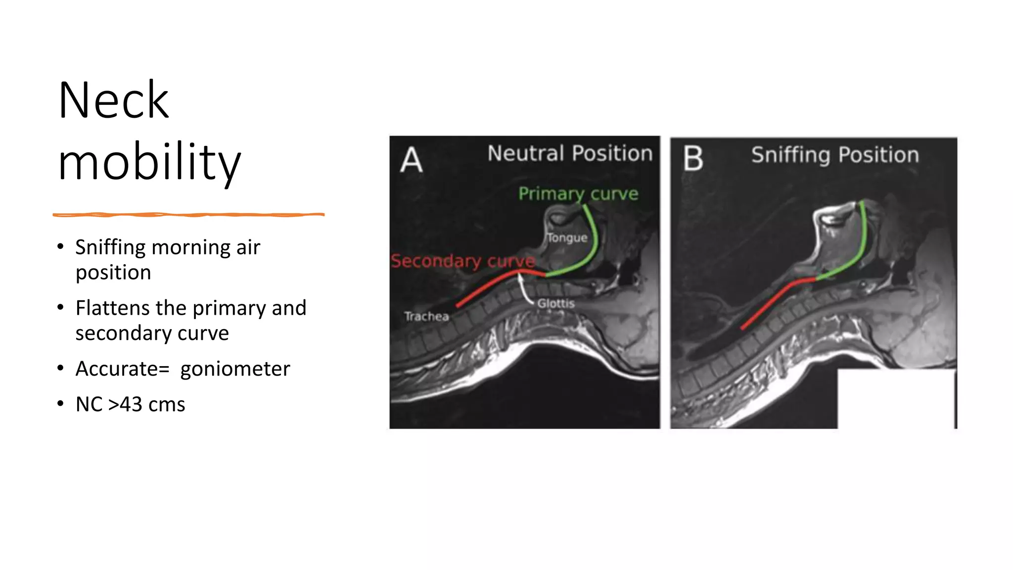 Difficult Airway.pptx